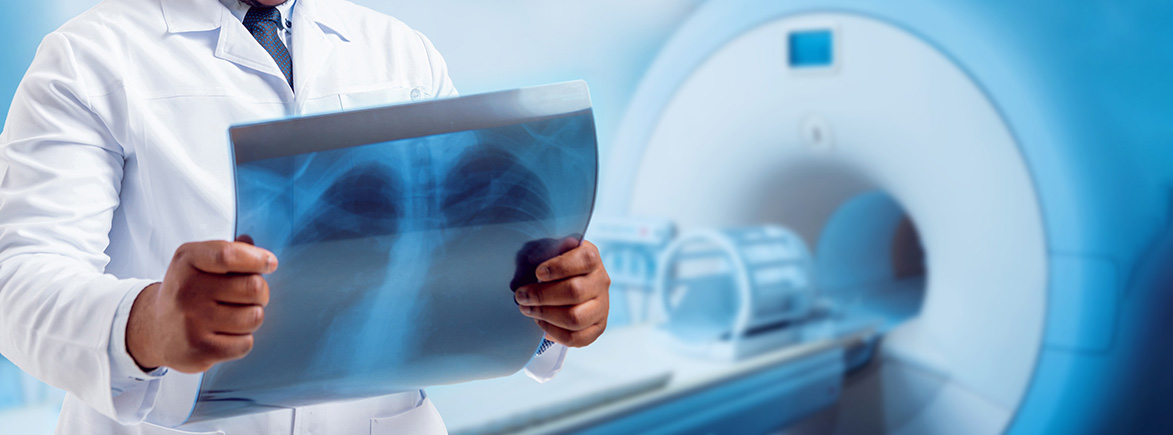 MRI פרטי: בדיקת MRI פרטית מהיום להיום | היועצת